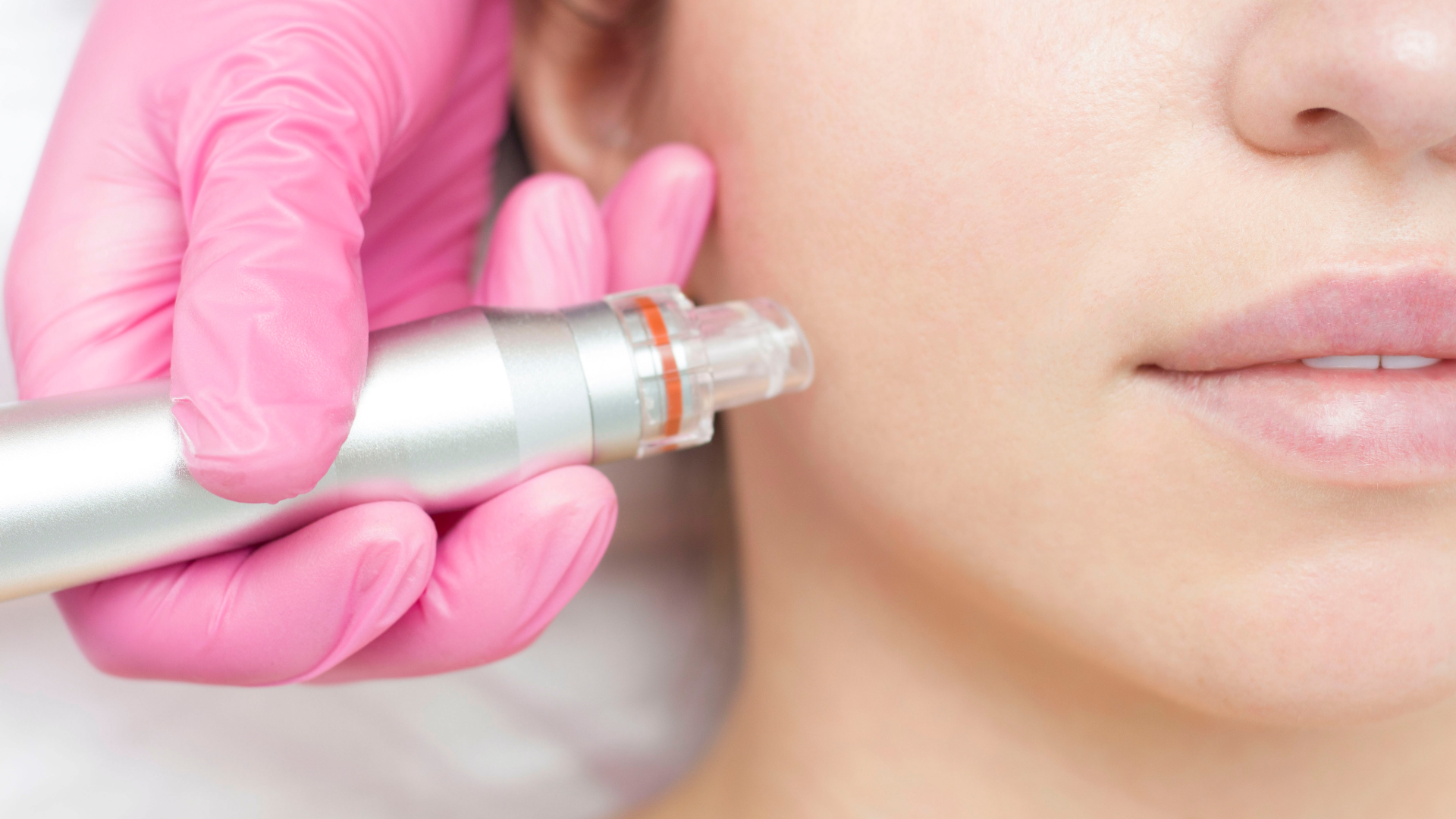 Meso Therapy – Nsight Aesthetics